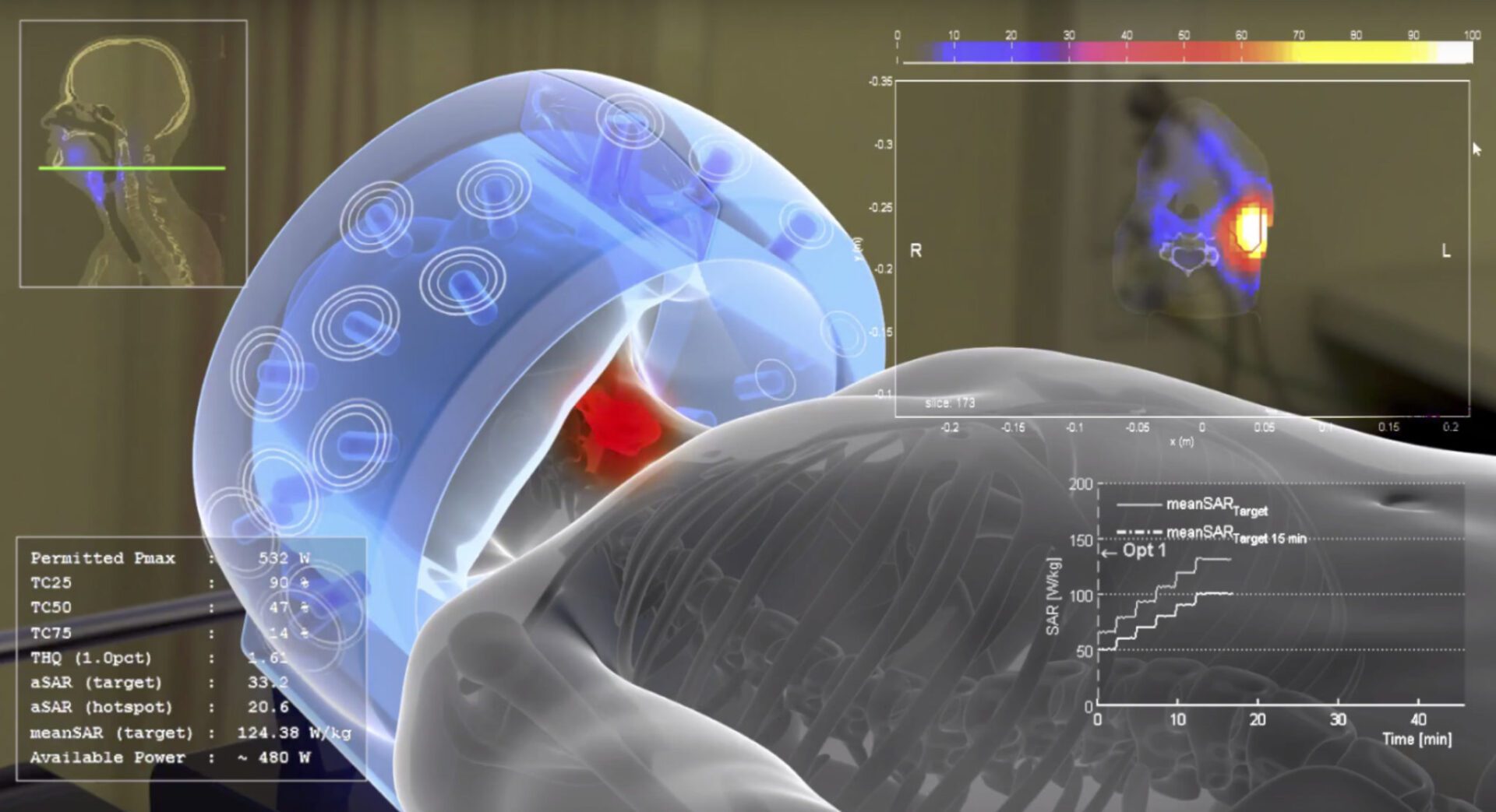 Head cancer treatment – Qindle